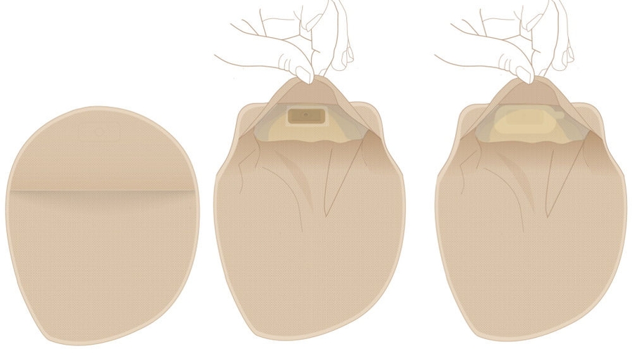 Swimming with Stoma: The Right Ostomy Swimwear | B. Braun Australia - B ...